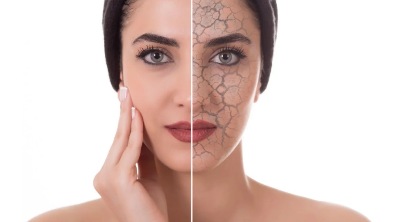 What Causes Dry Skin All Over the Body & How to Treat - Alaanah Lee